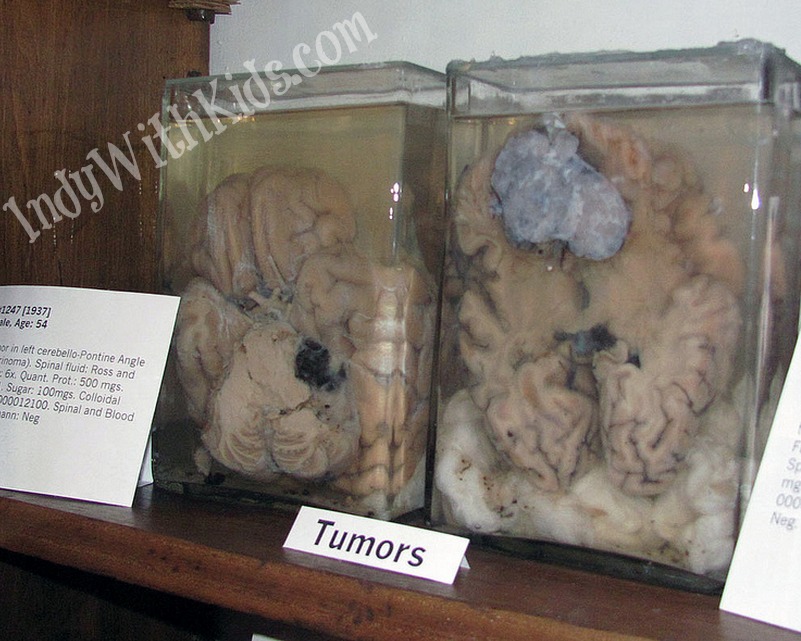 Indiana Medical History Museum - Indy with Kids